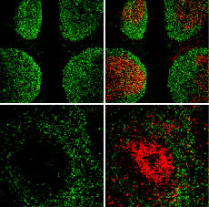 Cancer | Immunotechnology